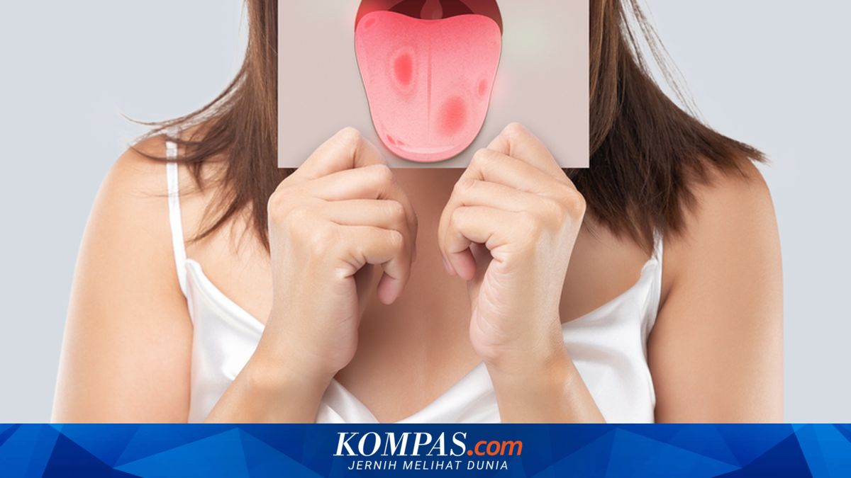 Penyakit Penyakit Behcet - Gejala, Penyebab, Pengobatan - Kompas.com
