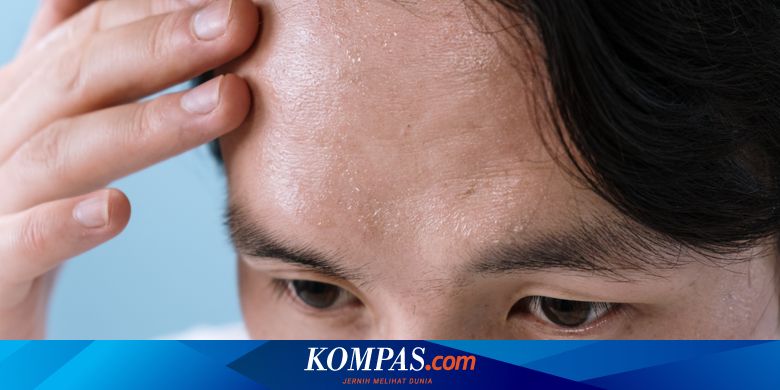 Mengenal Pemicu Keringat Berlebih dan Cara Mengatasinya
