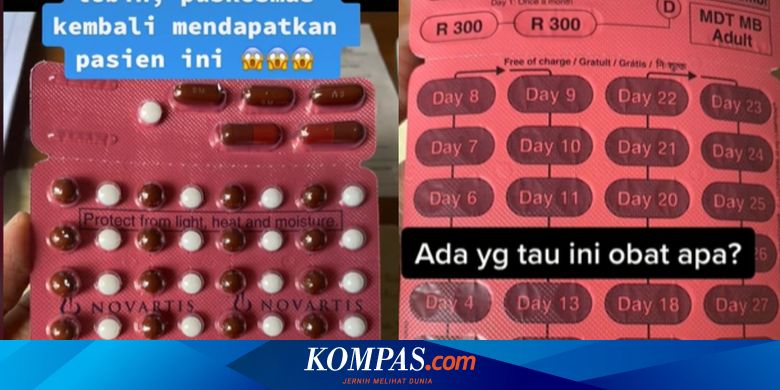 Viral, Unggahan Obat Penyakit Langka dan Menular Kusta, Ini Kata Dokter