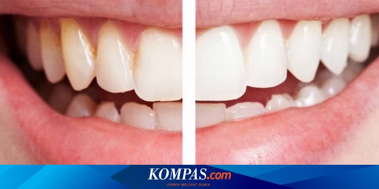 3 Cara Memutihkan Gigi Secara Alami