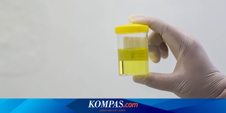 Studi Baru Temukan Cara Deteksi Dini Kanker lewat Urine