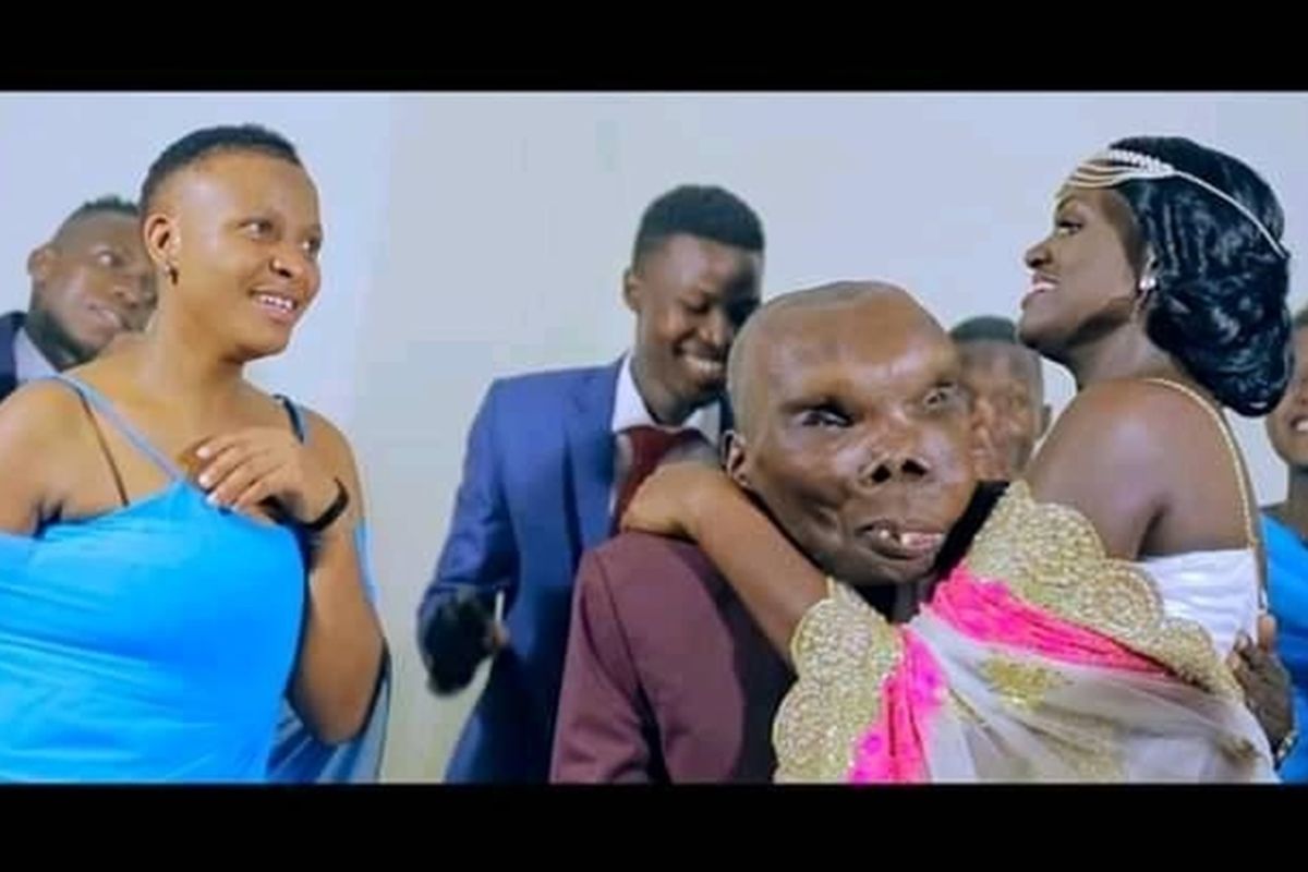 Kisah Pria Terjelek Uganda Godfrey Baguma: Penyanyi Sukses, Menikah 3 Kali