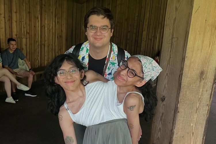 Kisah Nyata Kembar Siam Menikah, Carmen Andrade Temukan Cinta Sejati