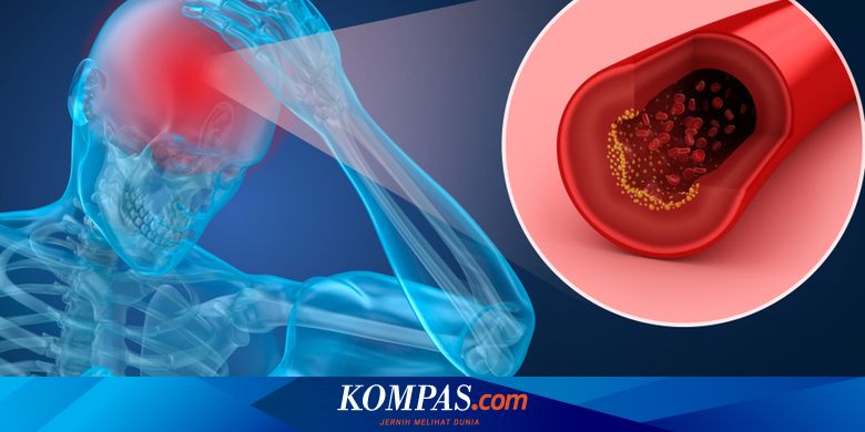 Kenali Tanda-tanda Penumpukan Plak dalam Pembuluh Darah
