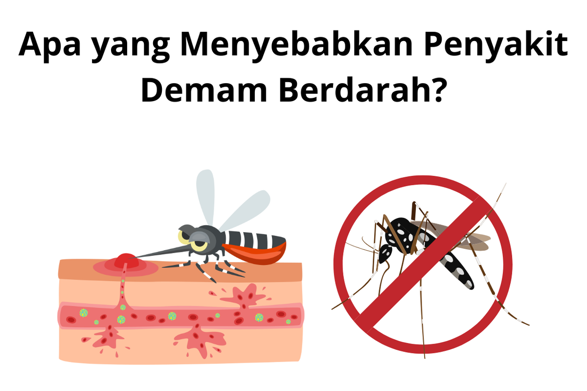 Dokter Ungkap DBD Lebih Mematikan dari ISPA, Simak Cara Mencegahnya