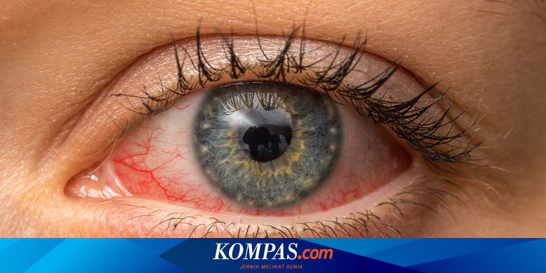 8 Penyebab Mata Merah Sebelah Kiri dan Cara Mengatasinya